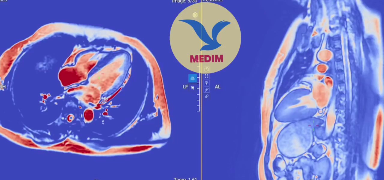 Chụp cộng hưởng từ (MRI) tim tại trung tâm chẩn đoán hình ảnh MEDIM ...