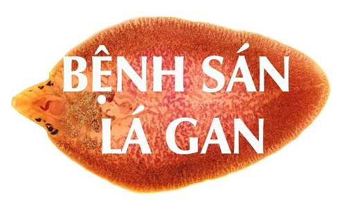 Xét nghiệm sán lá gan và những điều có thể bạn chưa biết | Medlatec