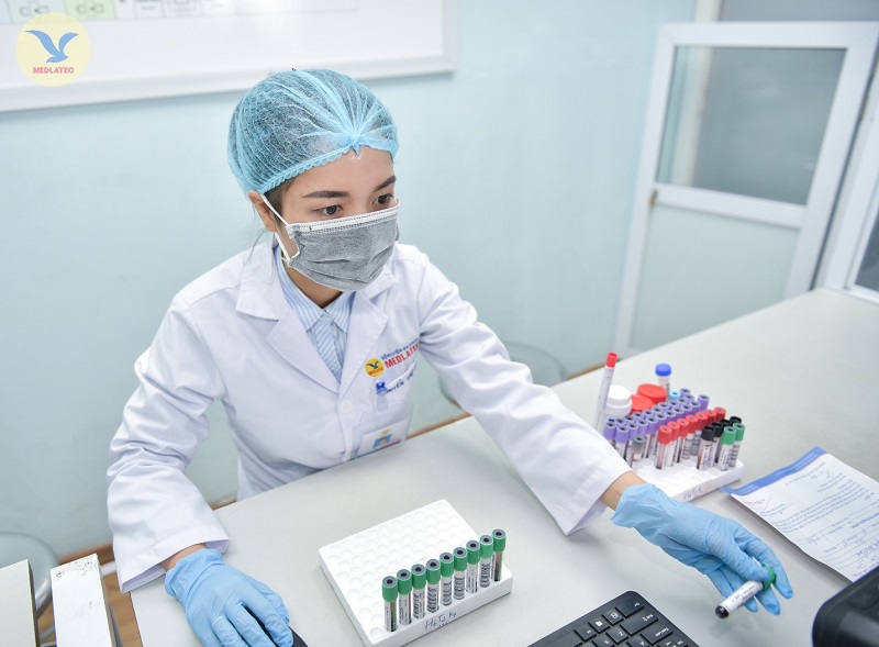 Tìm hiểu roma test là gì và các ứng dụng trong phân tích chẩn đoán y tế