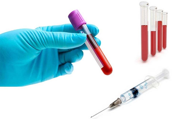 Tìm hiểu alpha 2 globulin là gì và vai trò trong sức khỏe con người