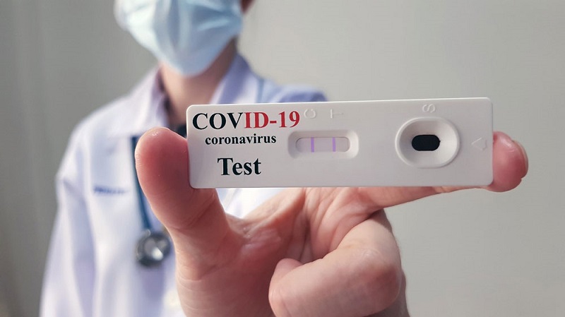 Khám phá viral test là gì và tại sao nó quan trọng trong chẩn đoán bệnh