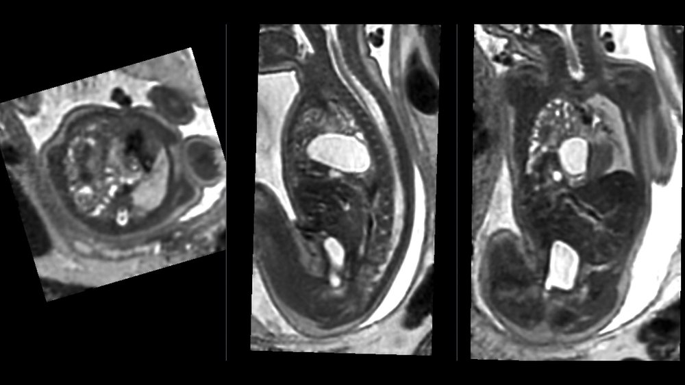 Những điều cần biết về chụp MRI khi mang thai | Medlatec