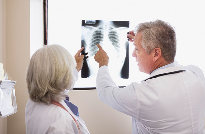 Diễn biến sức khỏe của bệnh nhân ung thư phổi giai đoạn cuối | Medlatec