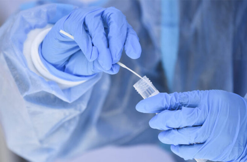 Cập nhật dịch vụ xét nghiệm PCR Long An mới nhất | Medlatec