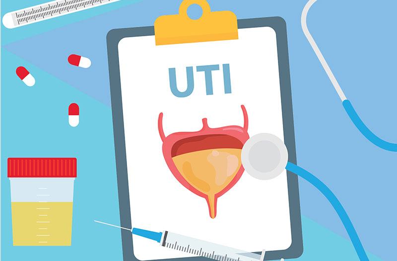 UTI là gì? Những vấn đề cơ bản về UTI | Medlatec